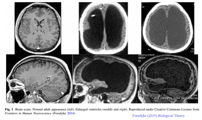 Myths and Mysteries of Mind, Body, and Consciousness. - Attractor Field ...